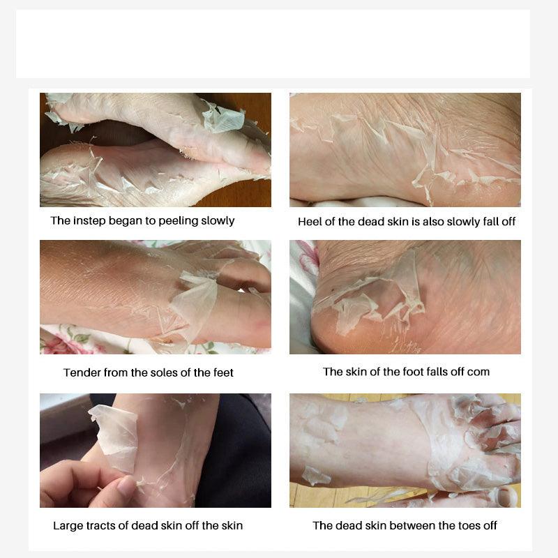 BABY FEET — FOOT PEEL MASK – B ANN'S BOUTIQUE, LLC